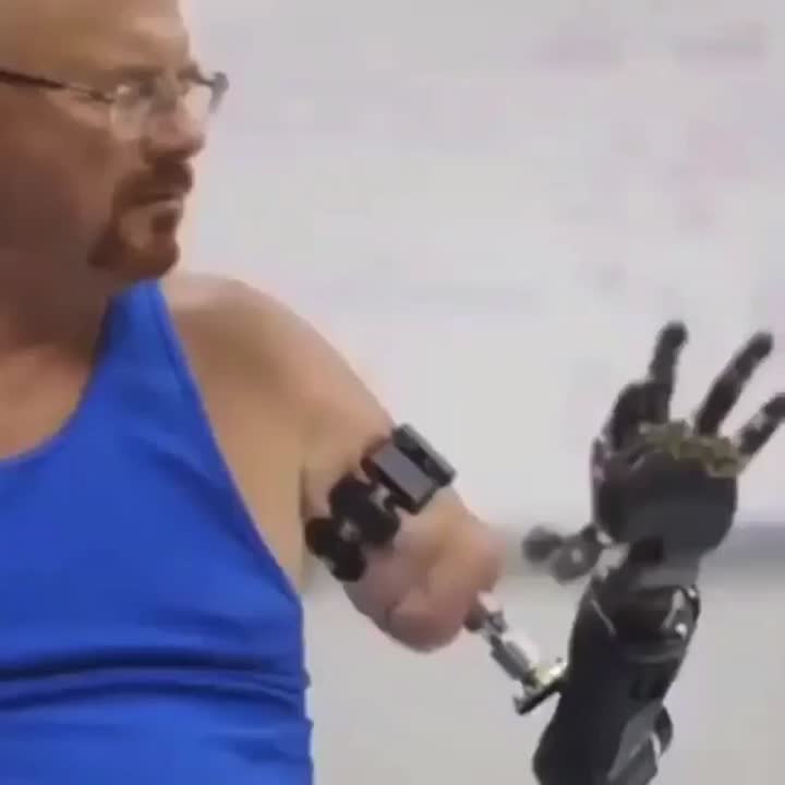 Anthony J James on LinkedIn: Mind controlled bionic arms from Atom ... Anthony J James on LinkedIn: Mind controlled bionic arms from Atom ...
