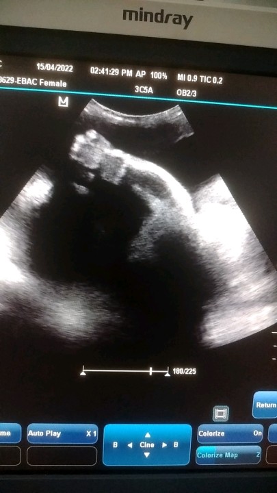 Shivam Jha on LinkedIn: #ultrasound #sonography #fetalultrasound Shivam Jha on LinkedIn: #ultrasound #sonography #fetalultrasound