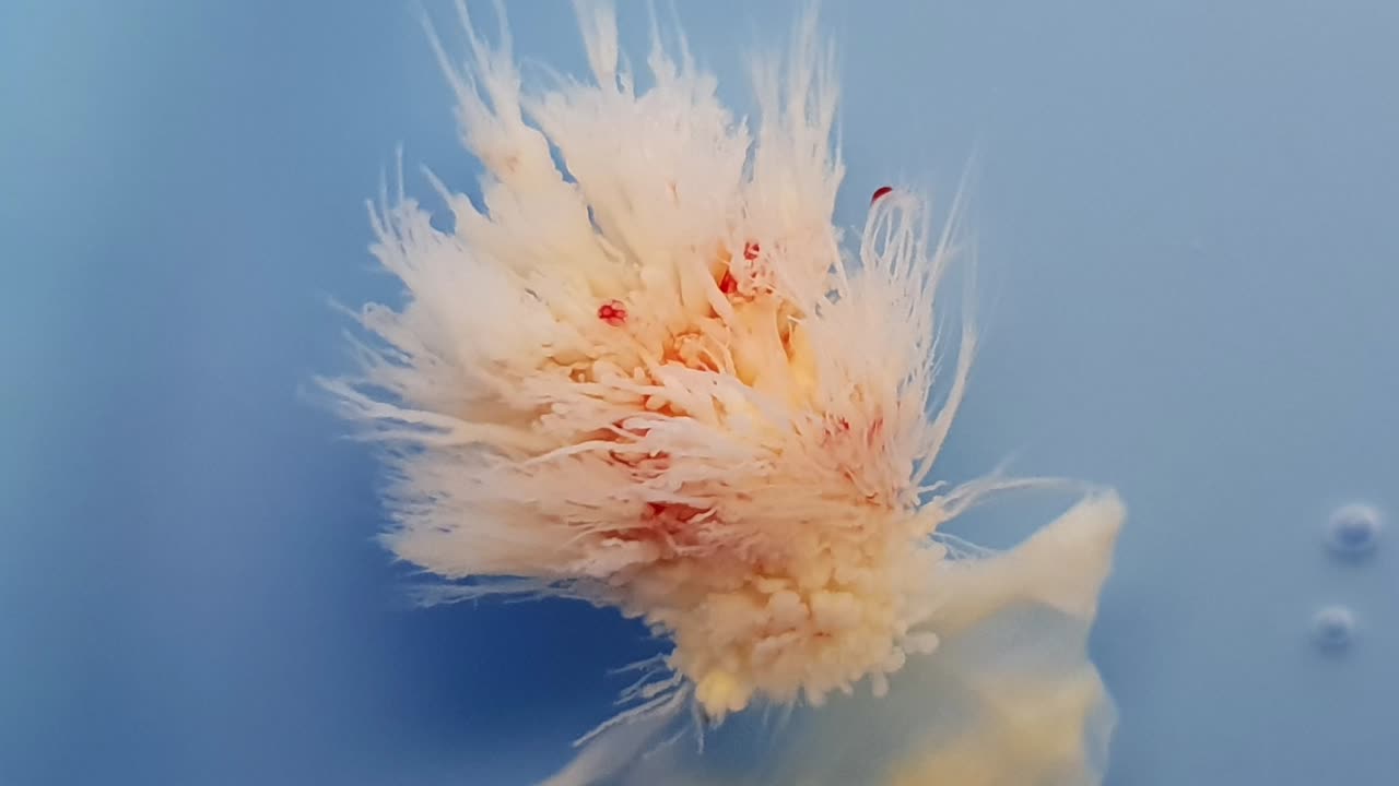 Prof. Dr. med Utz Kappert on LinkedIn: Papillary fibroelastoma ... sea ... Prof. Dr. med Utz Kappert on LinkedIn: Papillary fibroelastoma ... sea ...