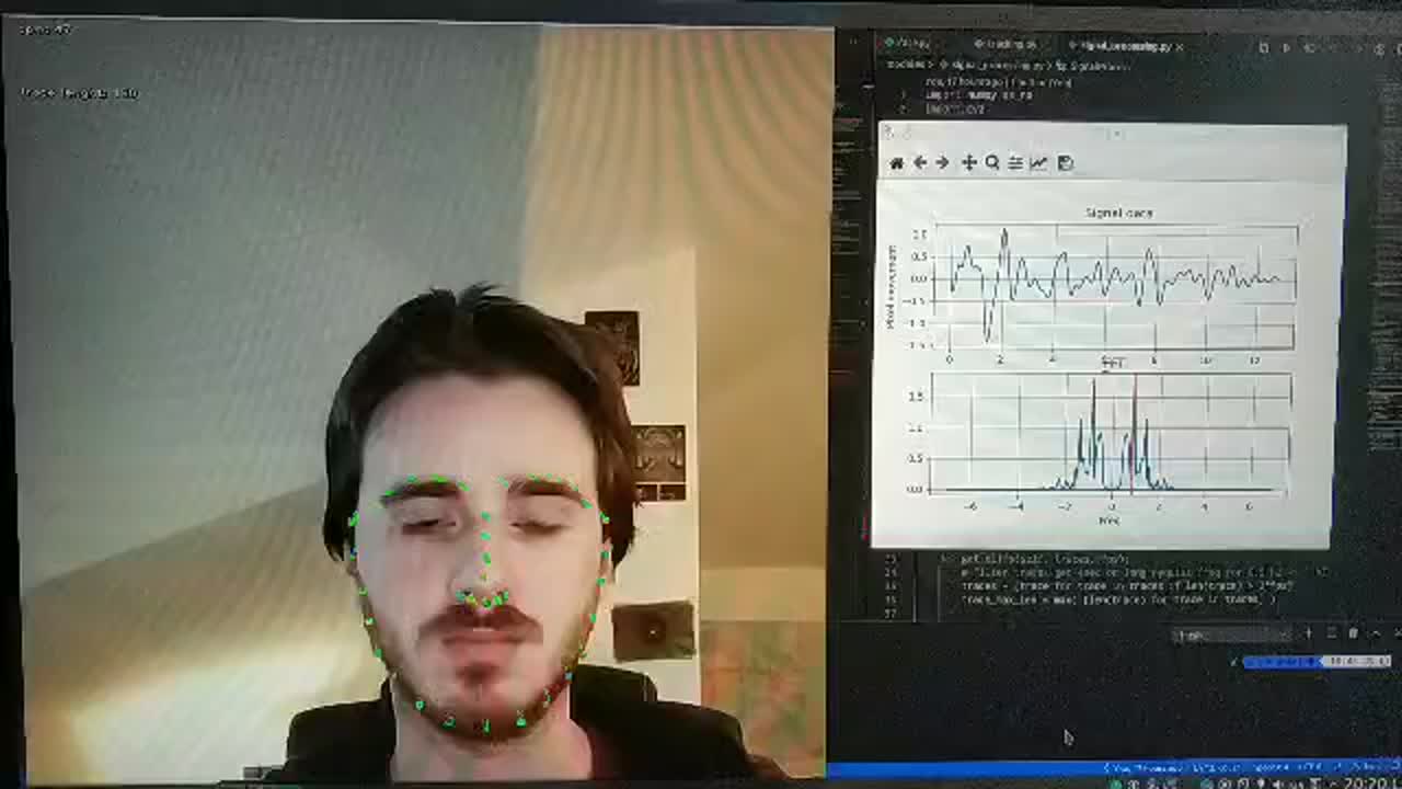 İrfan Bilaloğlu on LinkedIn: #python #opencv #signalprocessing # ... İrfan Bilaloğlu on LinkedIn: #python #opencv #signalprocessing # ...
