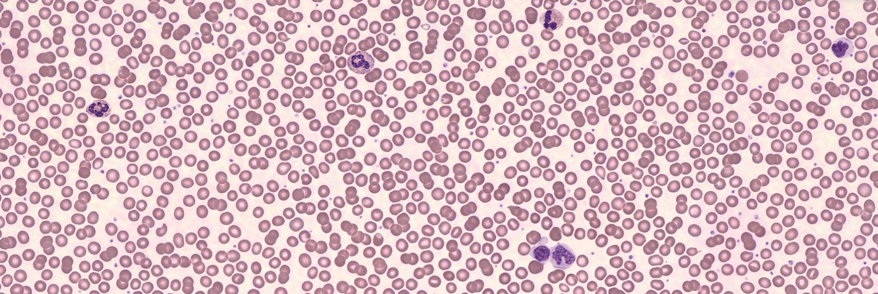 Normal Peripheral Blood Smear, 47% OFF Normal Peripheral Blood Smear, 47% OFF
