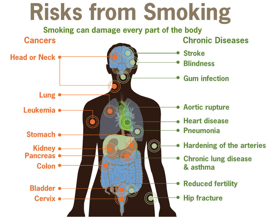 Smoking Permanently Damages Human DNA, Study Says Smoking Permanently Damages Human DNA, Study Says