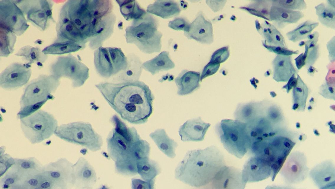 Carole Roland on LinkedIn: #cytoscreener Carole Roland on LinkedIn: #cytoscreener