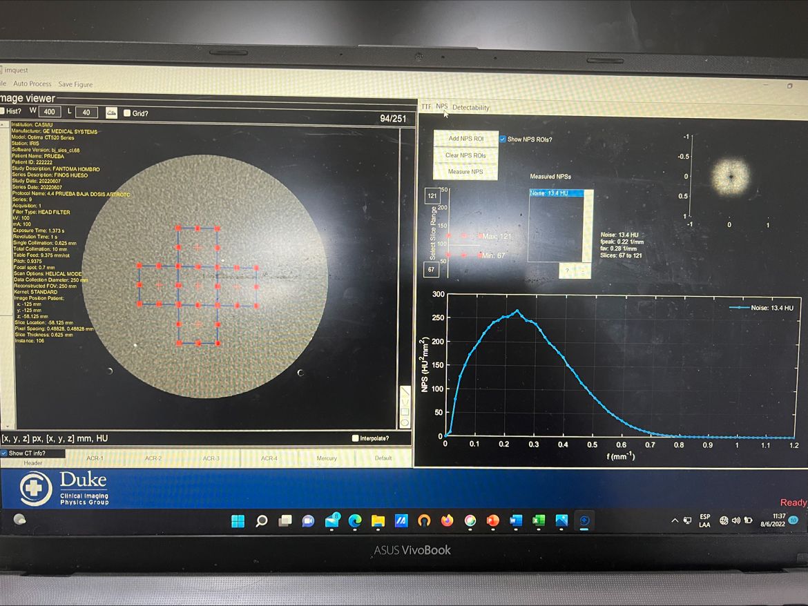 Marcel Frederico Alvarez on LinkedIn: Optimizing some low dose CT ... Marcel Frederico Alvarez on LinkedIn: Optimizing some low dose CT ...