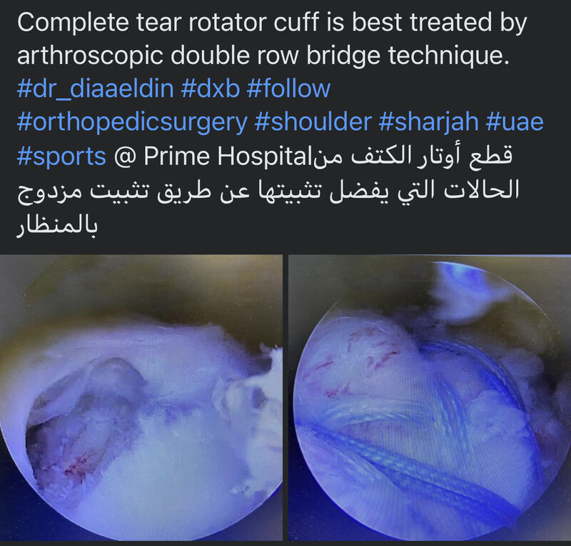 Diaa Youssef, MD, PhD. posted on LinkedIn Diaa Youssef, MD, PhD. posted on LinkedIn