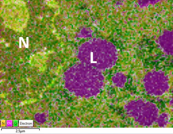 Oxford Instruments NanoAnalysis on LinkedIn: This is an EDS layered map ... Oxford Instruments NanoAnalysis on LinkedIn: This is an EDS layered map ...