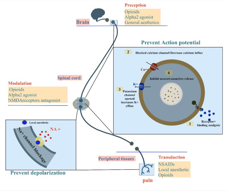 Dekan Ali di LinkedIn: Pain prevention mechanism Designed by dekan A.Raza. Dekan Ali di LinkedIn: Pain prevention mechanism Designed by dekan A.Raza.