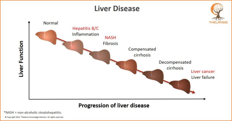 Pankaj Negi on LinkedIn: Progression of Liver Disease - THELANSIS Pankaj Negi on LinkedIn: Progression of Liver Disease - THELANSIS