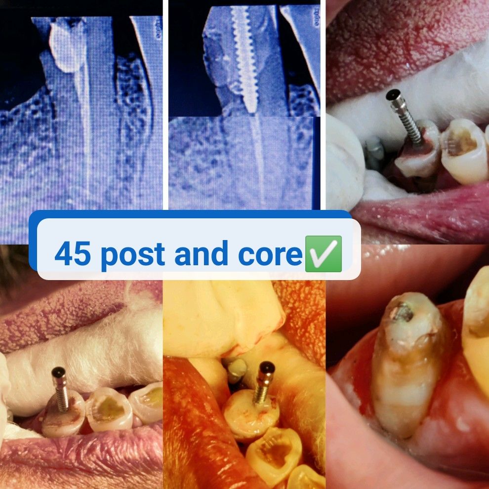 Dr.Harsh Verma posted on LinkedIn Dr.Harsh Verma posted on LinkedIn