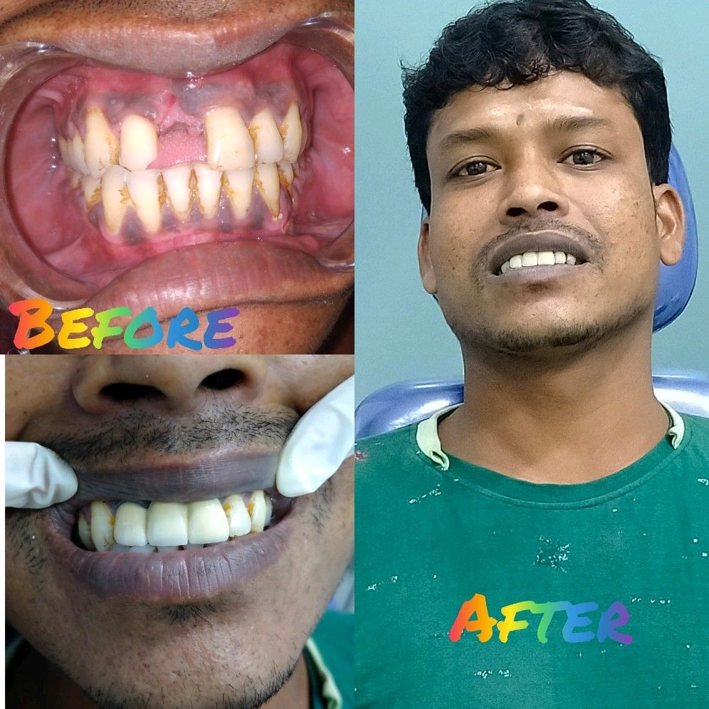 Dr Devanshi Modi on LinkedIn: #dentist #smile #dentistry #dental #teeth ... Dr Devanshi Modi on LinkedIn: #dentist #smile #dentistry #dental #teeth ...