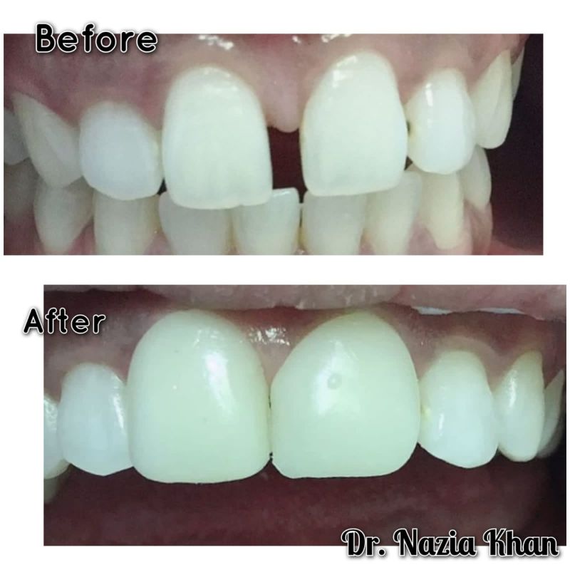 Dr Nazia khan on LinkedIn: #shade Dr Nazia khan on LinkedIn: #shade