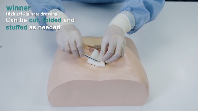 Cindy Zeng on LinkedIn: alginate dressing-winner medical Cindy Zeng on LinkedIn: alginate dressing-winner medical