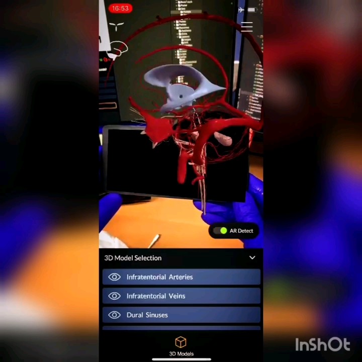 Fotis Petrou on LinkedIn: Testing one of my favourite app features with ... Fotis Petrou on LinkedIn: Testing one of my favourite app features with ...