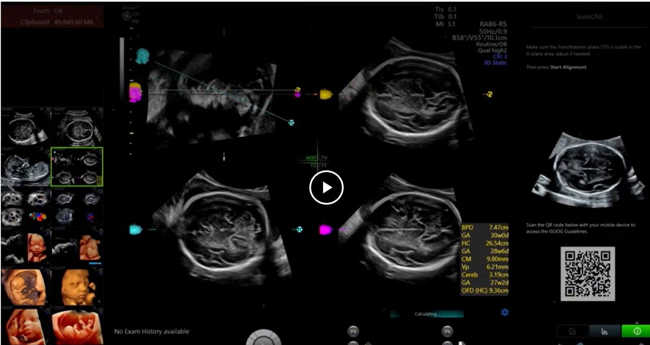 Voluson Ultrasound on LinkedIn: #voluson #ai #ultrasound #aitechnology Voluson Ultrasound on LinkedIn: #voluson #ai #ultrasound #aitechnology