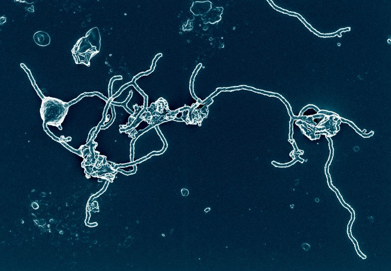 Archaea vs Batteri: troviamo le differenze! Archaea vs Batteri: troviamo le differenze!