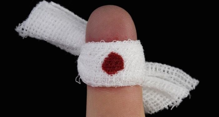 Use Of Tranexamic Acid To Prevent Postpartum Hemorrhage And Bleeding In ... Use Of Tranexamic Acid To Prevent Postpartum Hemorrhage And Bleeding In ...