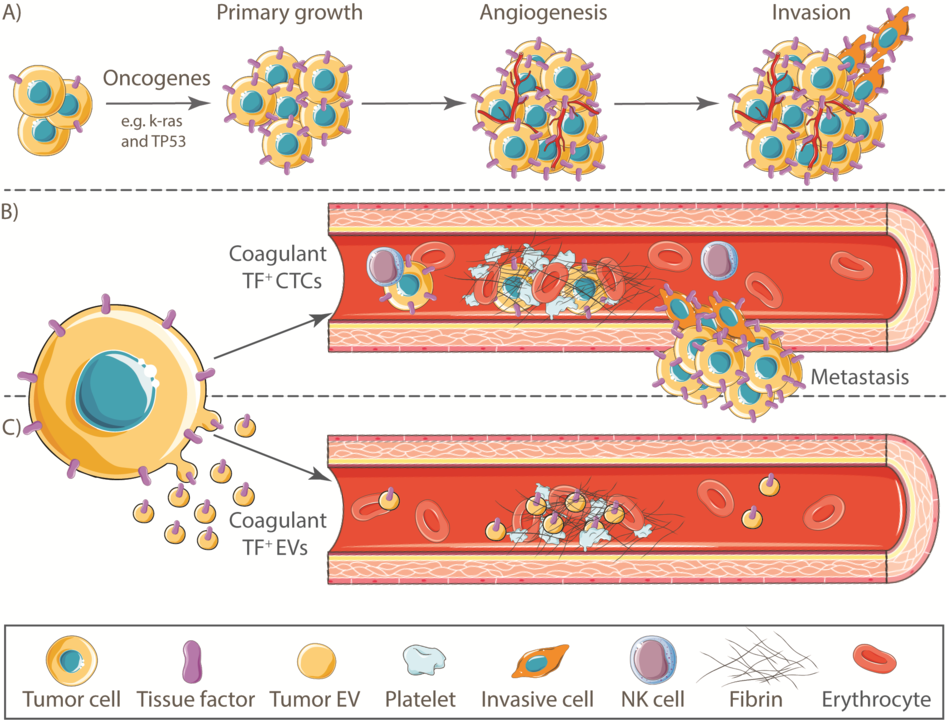 Everything you wanted to know about Tissue Factor & Cancer. Everything you wanted to know about Tissue Factor & Cancer.