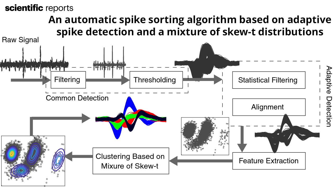 An automatic spike sorting algorithm based on adaptive spike detection ... An automatic spike sorting algorithm based on adaptive spike detection ...