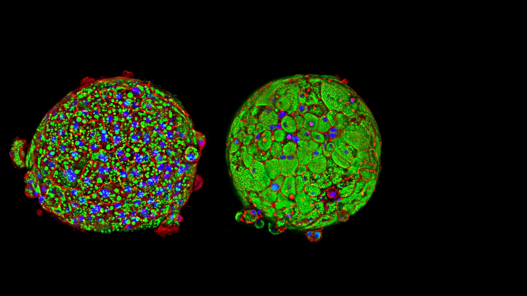 Society of Biomolecular Imaging and Informatics on LinkedIn: Label-free ... Society of Biomolecular Imaging and Informatics on LinkedIn: Label-free ...