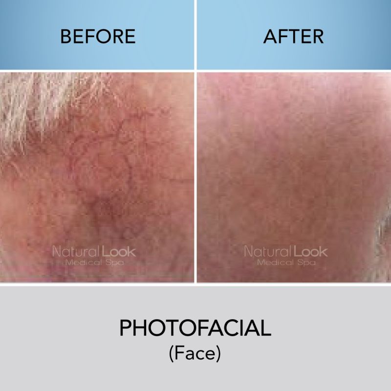 Natural Look Medical Spa on LinkedIn: #beauty #collagen #aesthetics # ... Natural Look Medical Spa on LinkedIn: #beauty #collagen #aesthetics # ...