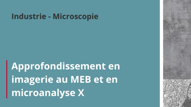 Cnam Entreprises on LinkedIn: Approfondissement en imagerie au MEB et ... Cnam Entreprises on LinkedIn: Approfondissement en imagerie au MEB et ...