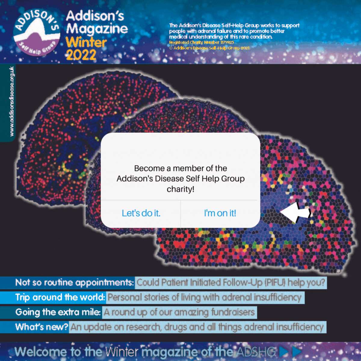 Addison's Disease Self Help Group on LinkedIn: #shareyourkit Addison's Disease Self Help Group on LinkedIn: #shareyourkit