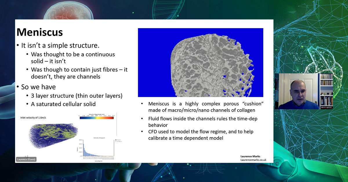TECHNIA Simulation on LinkedIn: SIMIF 2022 Series | Life Sciences | TECHNIA TECHNIA Simulation on LinkedIn: SIMIF 2022 Series | Life Sciences | TECHNIA