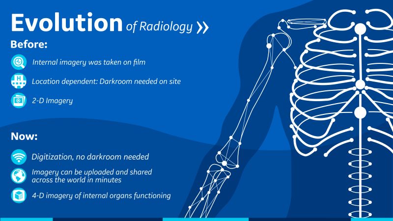 Archana A Mukherjee on LinkedIn: #radiology Archana A Mukherjee on LinkedIn: #radiology