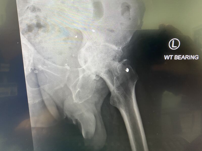 Mamun Al Rashid MD MRCS FRCS FACS auf LinkedIn: #surgery # ... Mamun Al Rashid MD MRCS FRCS FACS auf LinkedIn: #surgery # ...