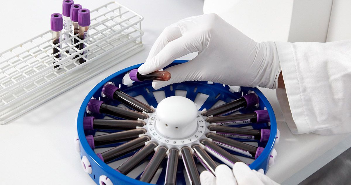 Zeeshan Bashir on LinkedIn: Laboratory diagnostic testing - Boule Zeeshan Bashir on LinkedIn: Laboratory diagnostic testing - Boule