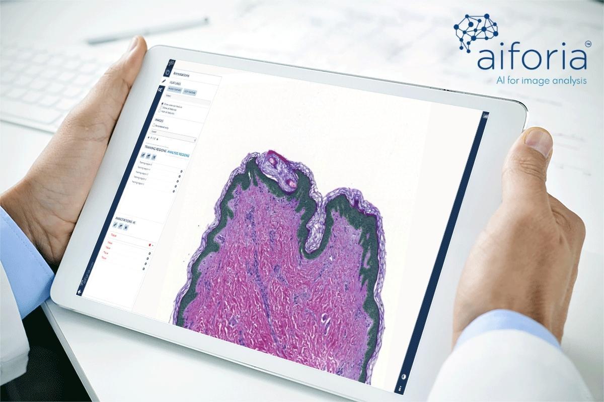 Heidi Rannikko on LinkedIn: Fimmic Launches Aiforia™ Cloud, Bringing ... Heidi Rannikko on LinkedIn: Fimmic Launches Aiforia™ Cloud, Bringing ...