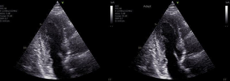 CIUS - Centre for Innovative Ultrasound Solutions on LinkedIn ... CIUS - Centre for Innovative Ultrasound Solutions on LinkedIn ...