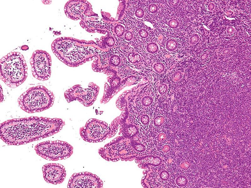 National Cancer Institute (NCI) on LinkedIn: A recent drug approval by ... National Cancer Institute (NCI) on LinkedIn: A recent drug approval by ...