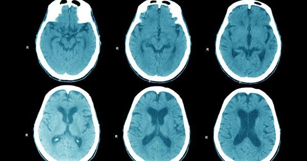 Elizabeth Dufour on LinkedIn: Different Types Of Meditation Change ... Elizabeth Dufour on LinkedIn: Different Types Of Meditation Change ...