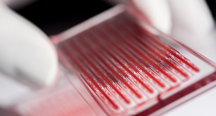 Microfluidics industry: what will trigger the next growth spurt? Microfluidics industry: what will trigger the next growth spurt?