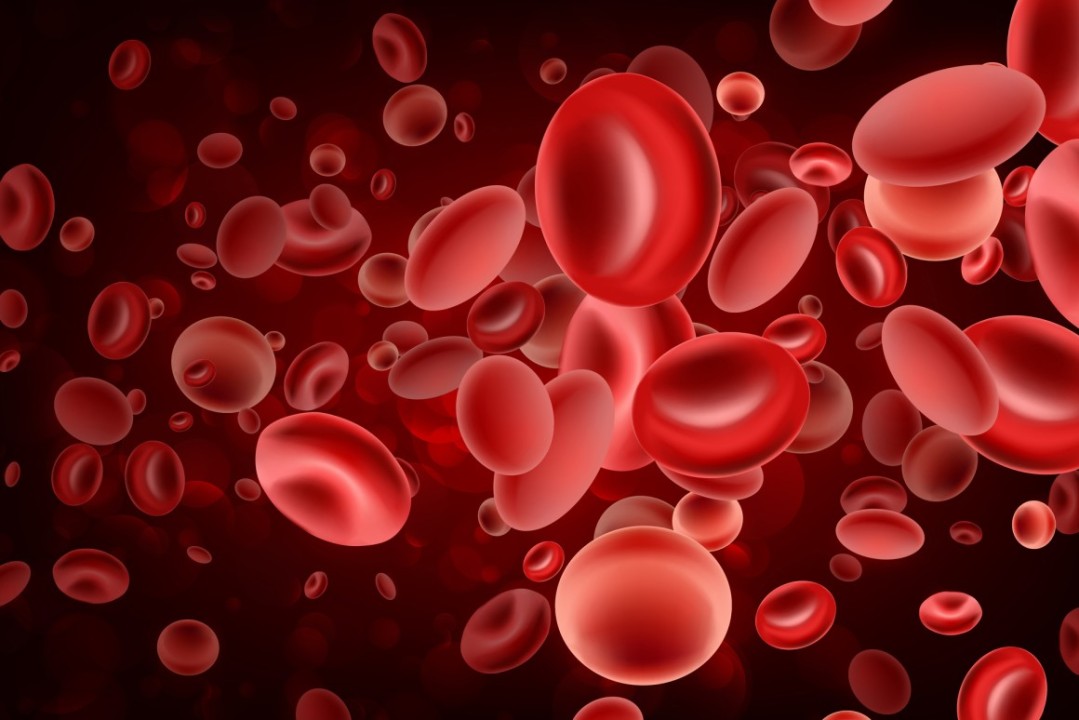 Anemia- Understanding the cause and prevention methods(Diet plan included) Anemia- Understanding the cause and prevention methods(Diet plan included)
