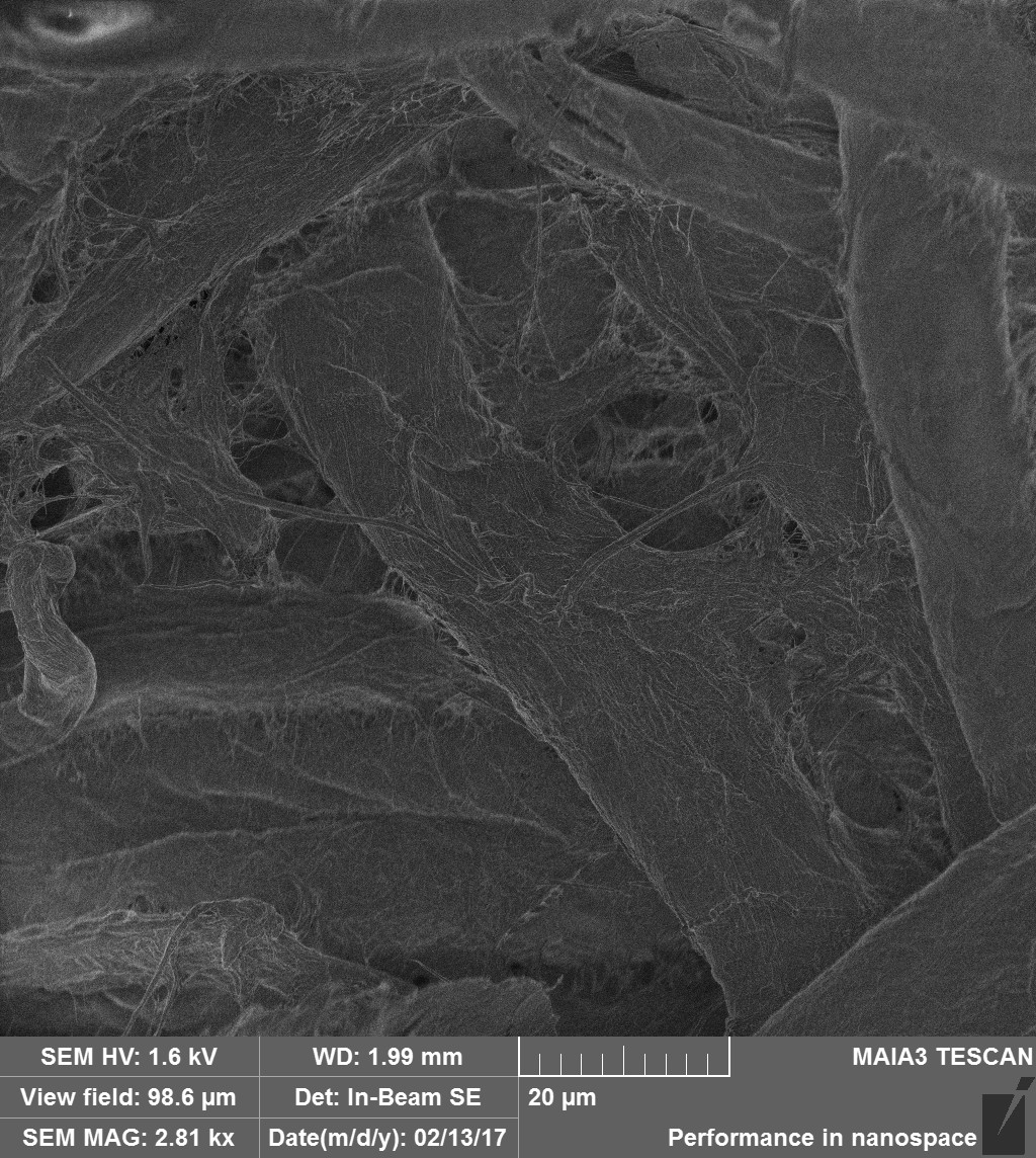 Yi-Xiang Chang on LinkedIn: Howto SEM-image untreated / uncoated non ... Yi-Xiang Chang on LinkedIn: Howto SEM-image untreated / uncoated non ...