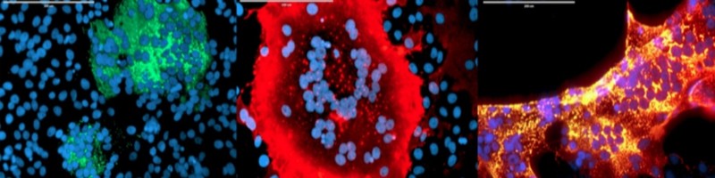 Rowida Abdelgalel, Ph.D. - AVEO Oncology | LinkedIn Rowida Abdelgalel, Ph.D. - AVEO Oncology | LinkedIn