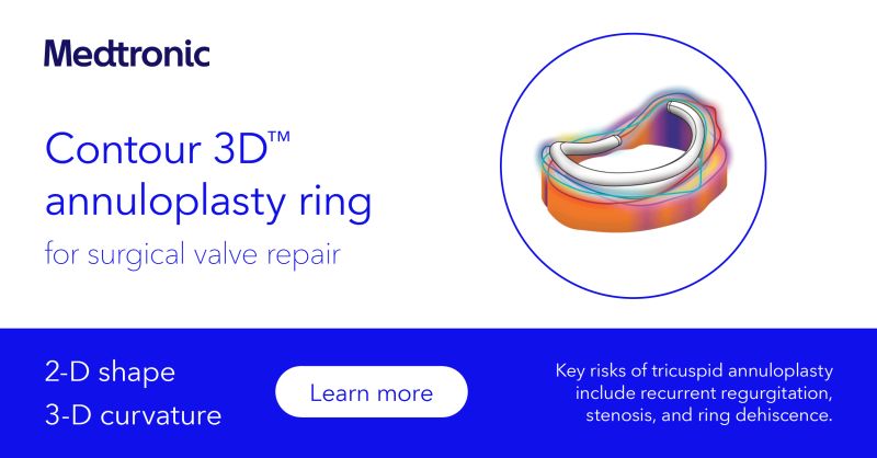 Medtronic Cardiac and Vascular on LinkedIn: Contour 3D Annuloplasty ... Medtronic Cardiac and Vascular on LinkedIn: Contour 3D Annuloplasty ...