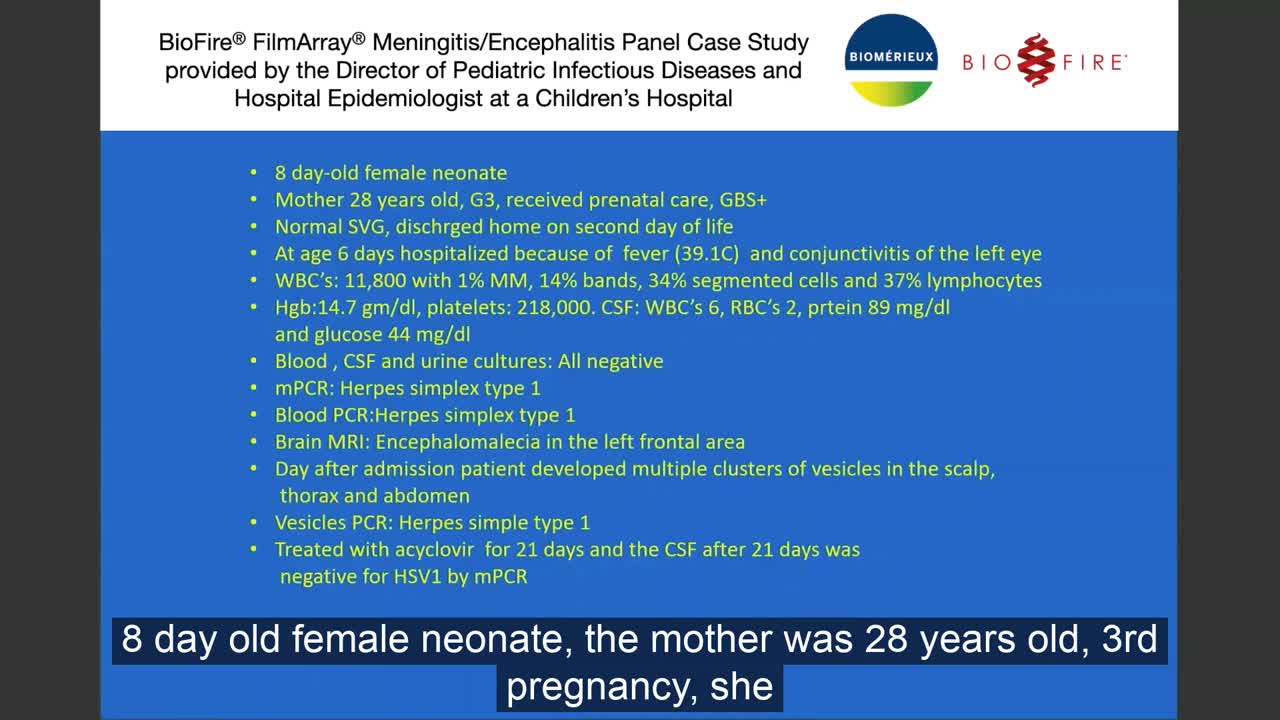 Dr. SOMESHWARAN R on LinkedIn: BioFire® FilmArray® Meningitis ... Dr. SOMESHWARAN R on LinkedIn: BioFire® FilmArray® Meningitis ...