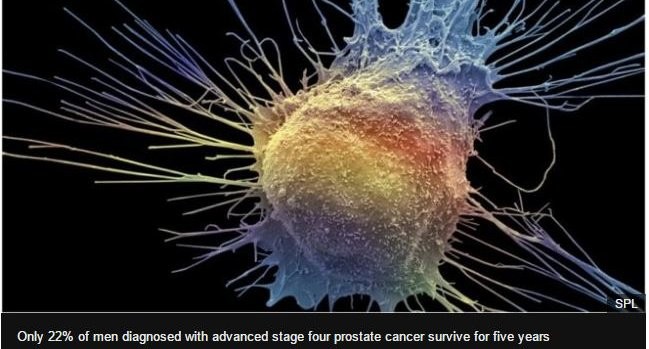 Ulster scientists claim prostate cancer 'discovery' Ulster scientists claim prostate cancer 'discovery'