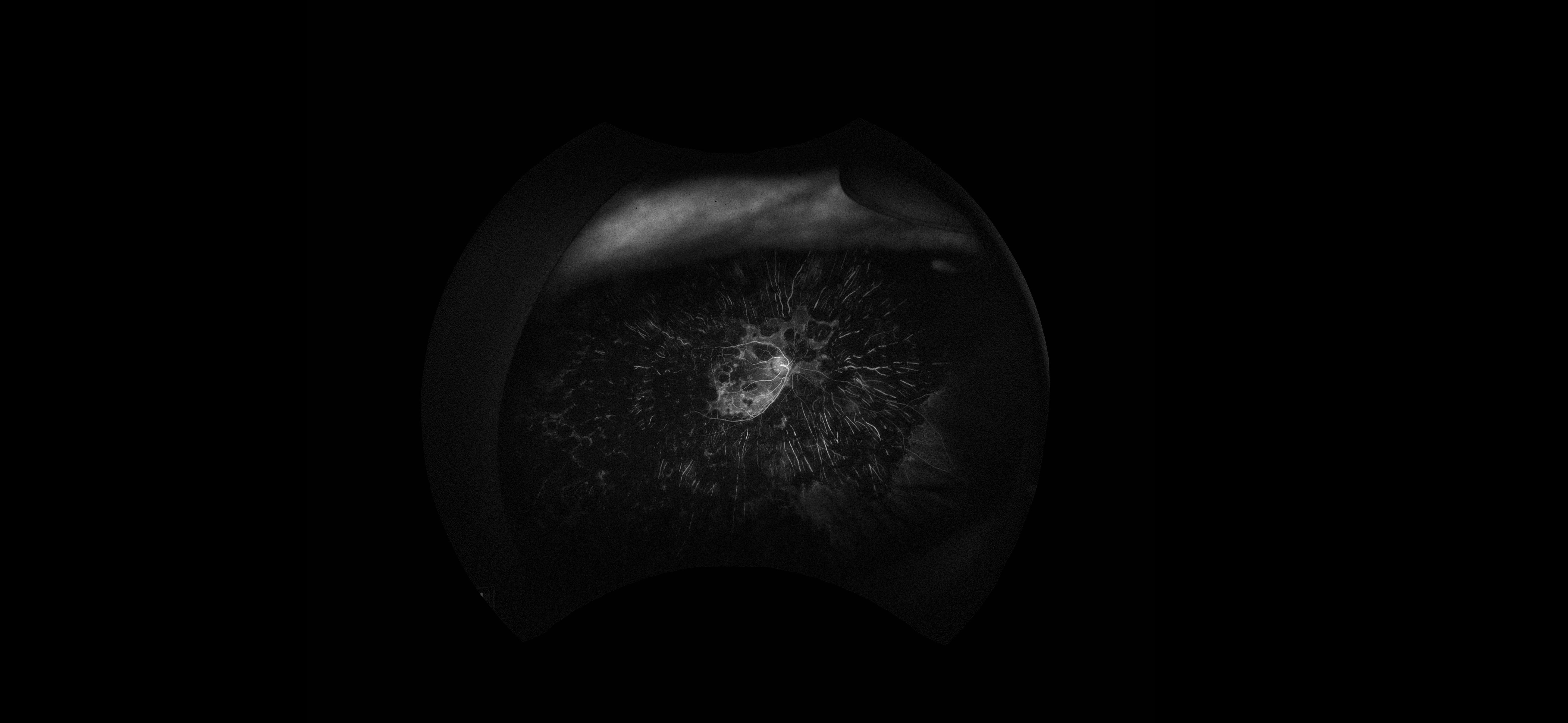 California Retina Consultants | LinkedIn California Retina Consultants | LinkedIn