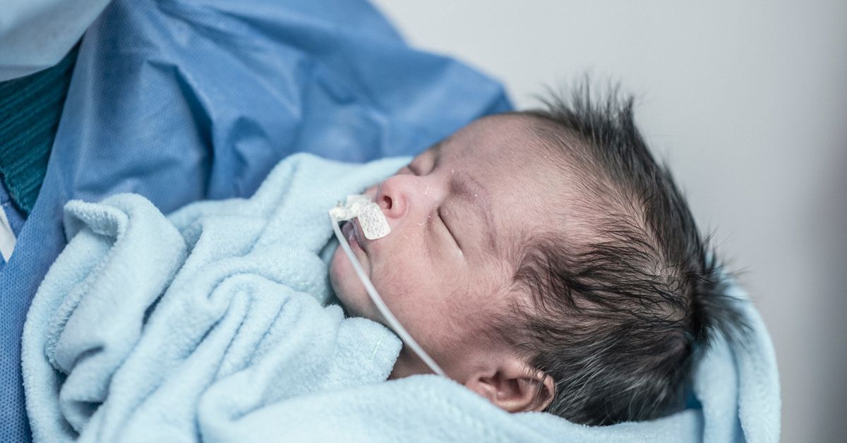 Anduin Anderle on LinkedIn: #preemies #hie #nicu #neonatal #nurses # ... Anduin Anderle on LinkedIn: #preemies #hie #nicu #neonatal #nurses # ...