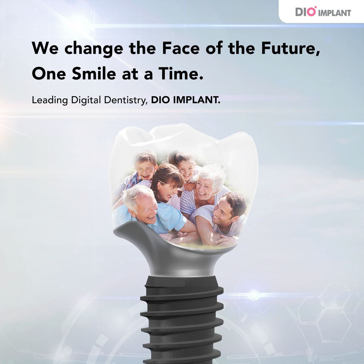 DIO Corporation on LinkedIn: #dio #dioimplant #digitalimplant #dionavi ... DIO Corporation on LinkedIn: #dio #dioimplant #digitalimplant #dionavi ...