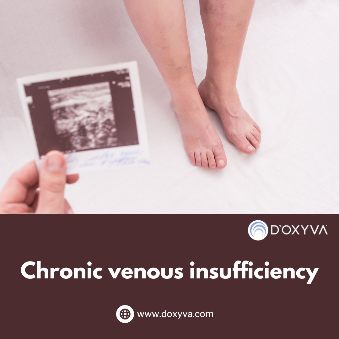 D'OXYVA on LinkedIn: #bloodcirculation #bloodflow #circulation # ... D'OXYVA on LinkedIn: #bloodcirculation #bloodflow #circulation # ...