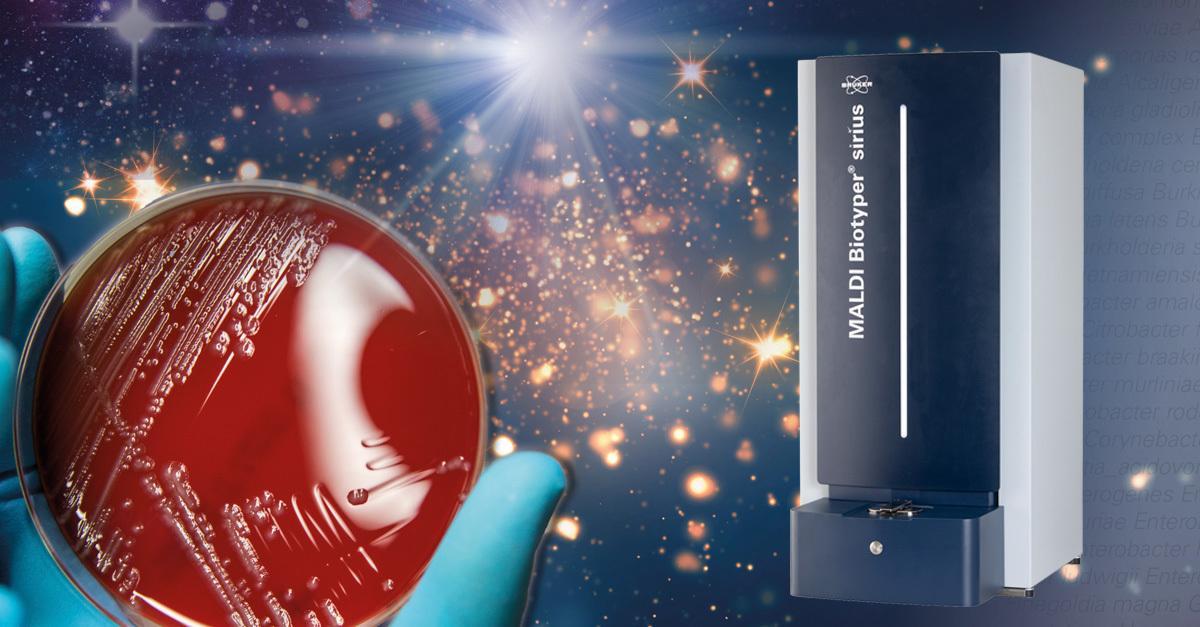 Bruker Daltonics on LinkedIn: Bruker Launches MALDI Biotyper® sirius at ... Bruker Daltonics on LinkedIn: Bruker Launches MALDI Biotyper® sirius at ...