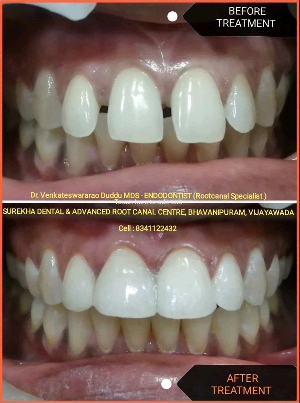 Dr.Venkateswara Rao Duddu posted on LinkedIn Dr.Venkateswara Rao Duddu posted on LinkedIn