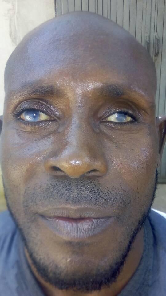 Amb. Hassan Umar on LinkedIn: SAVE MOHAMMED ALHAJI ISA SUFFERING FROM ... Amb. Hassan Umar on LinkedIn: SAVE MOHAMMED ALHAJI ISA SUFFERING FROM ...