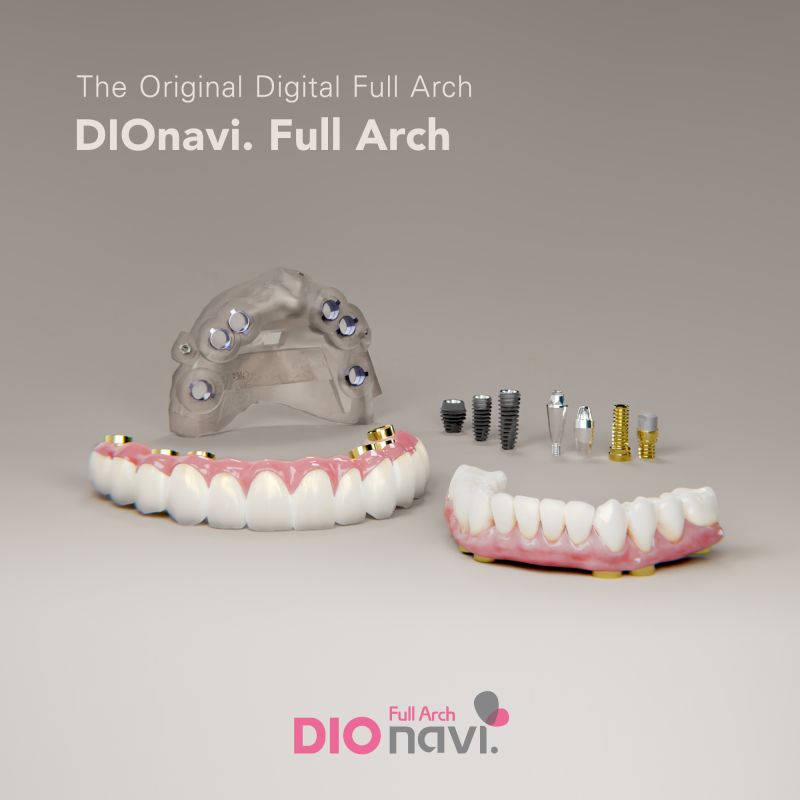 DIO Corporation on LinkedIn: #dio #dioimplant #digitaldentistry # ... DIO Corporation on LinkedIn: #dio #dioimplant #digitaldentistry # ...