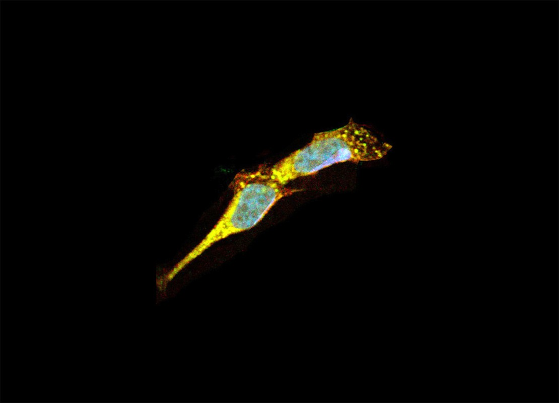 The National Institutes of Health on LinkedIn: Protein affected by rare ... The National Institutes of Health on LinkedIn: Protein affected by rare ...
